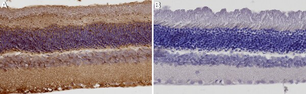 Anti-Cone Arrestin Antibody | AB15282